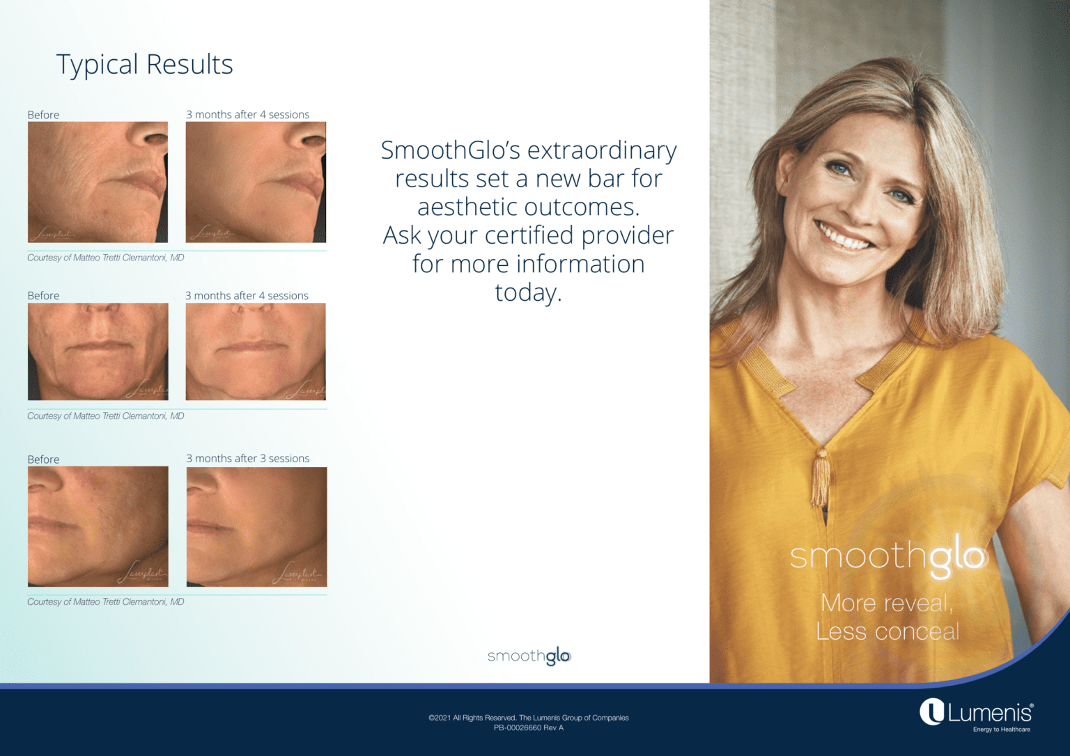 Radiant Skin with SmoothGlo™ Treatment in El Paso, TX - Rejuvené MD